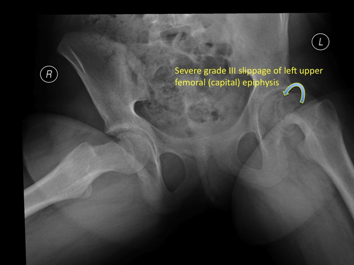 Ed Bache Paediatric Young Adult Orthopaedic Surgeon Ed Bache Paediatric Young Adult Orthopaedic Surgeon